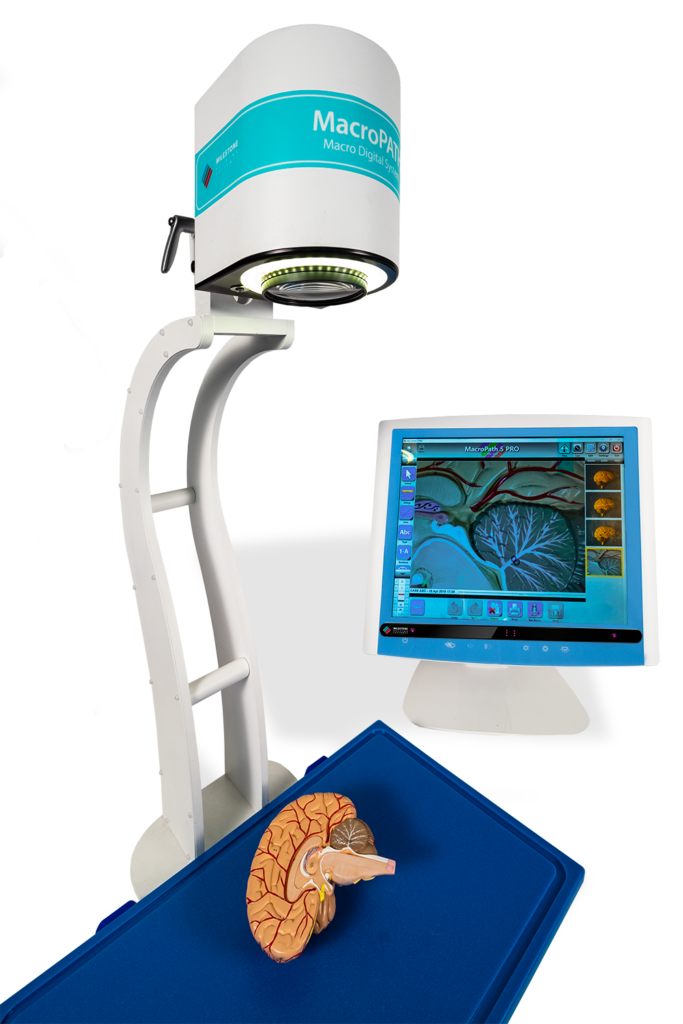 Eye-Control for MacroPATH - Meximp Technologies